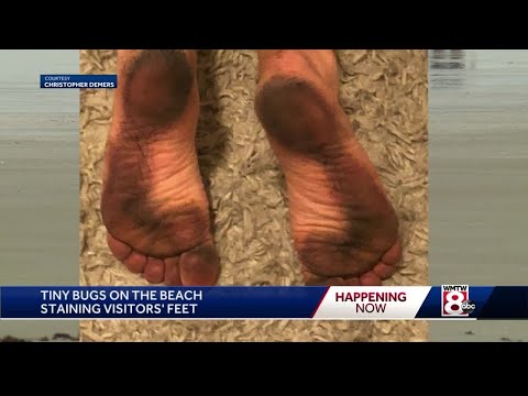 Beach Bugs Causing Stained Feet – 92.3 WIL