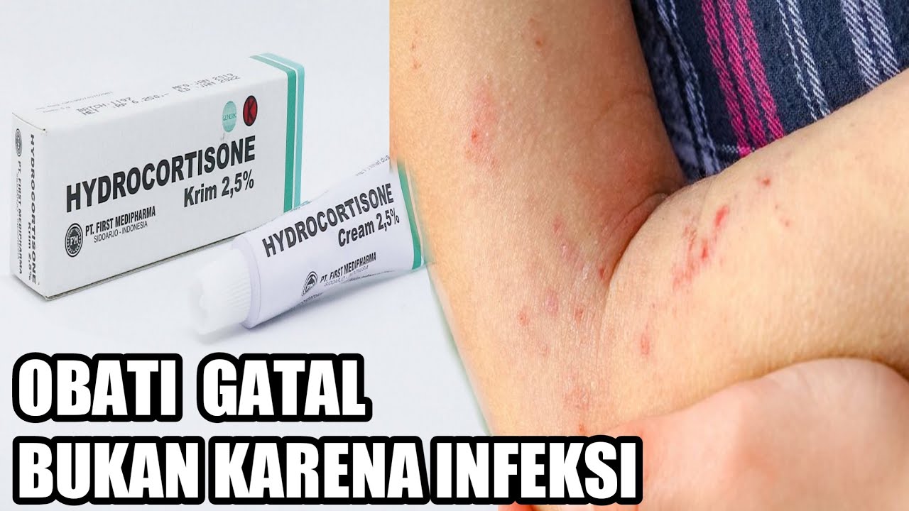 Obat gatal kulit eksim gatal alergi kadas kurap kutu air - YouTube