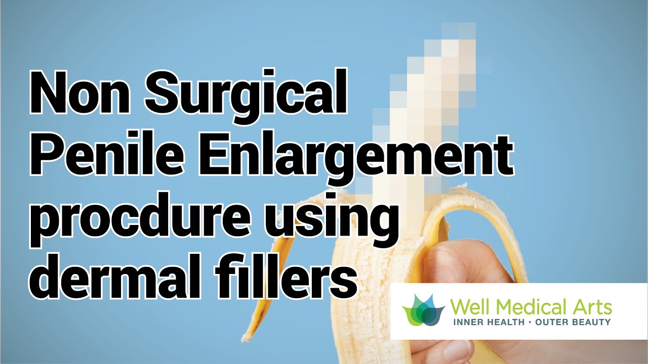 Non-surgical Penis Enlargement first Treatment with Before and After in ...