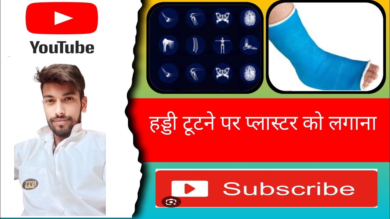 haddi Tut Jaye to kya karne chahiye/haddi Tutna par plaster kisa lagya ...