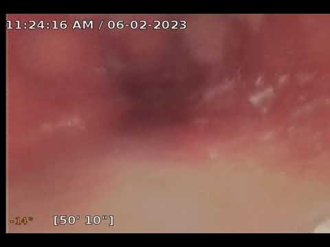 2669 East 74th Street - YouTube