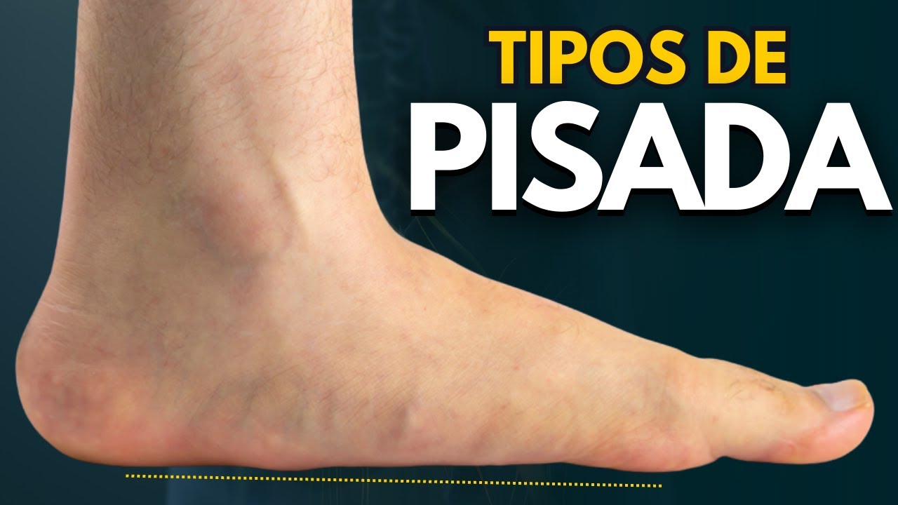 Como Saber Meu Tipo De Pisada - RETOEDU