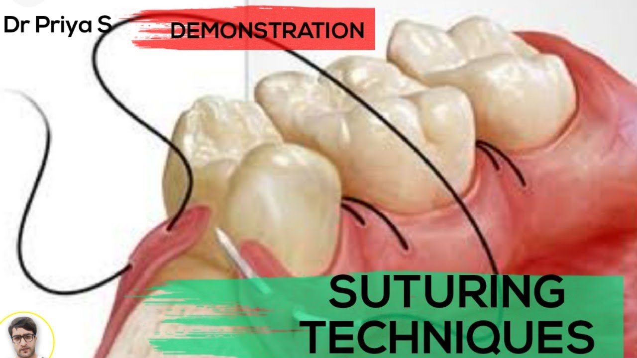 SUTURING TECHNIQUES-DEMONSTRATION - YouTube