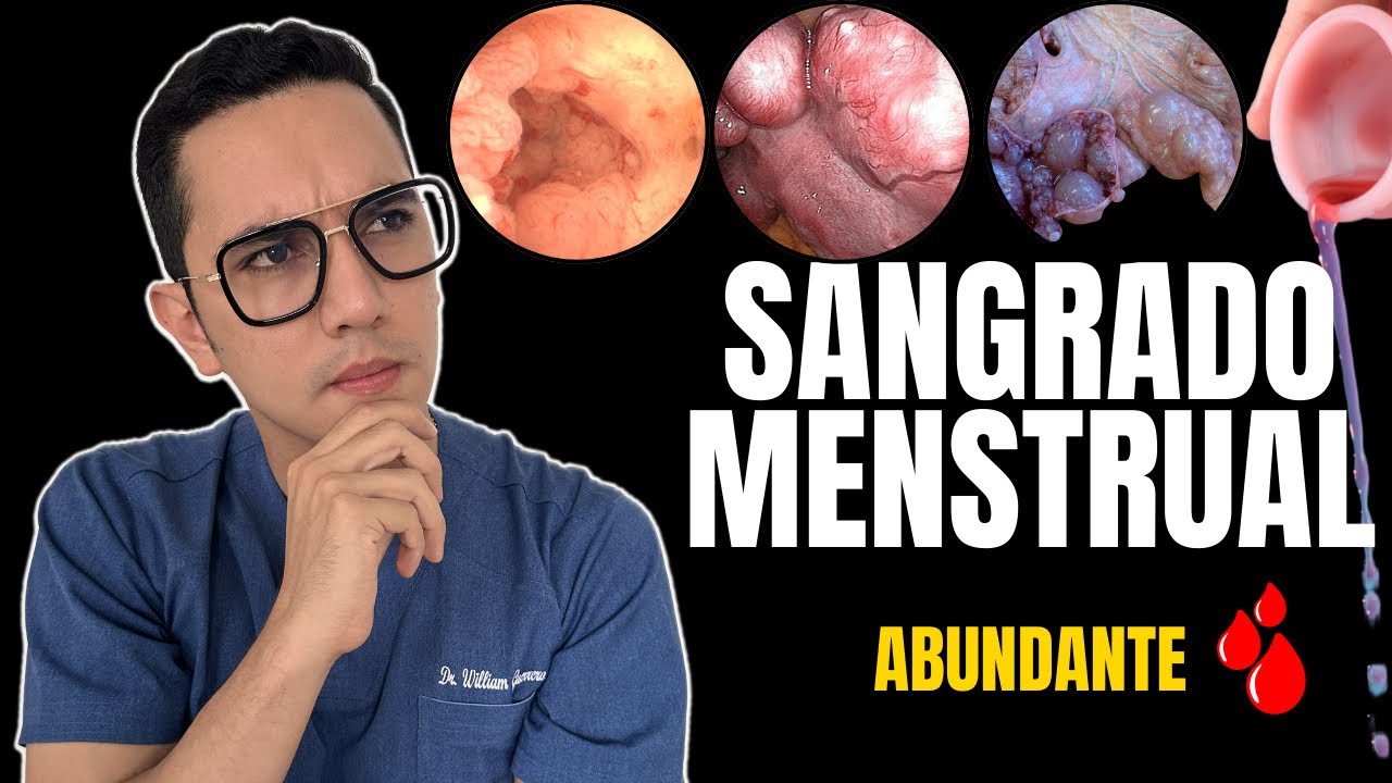 Sangrado menstrual abundante, todo lo que debes saber | Dr. William ...