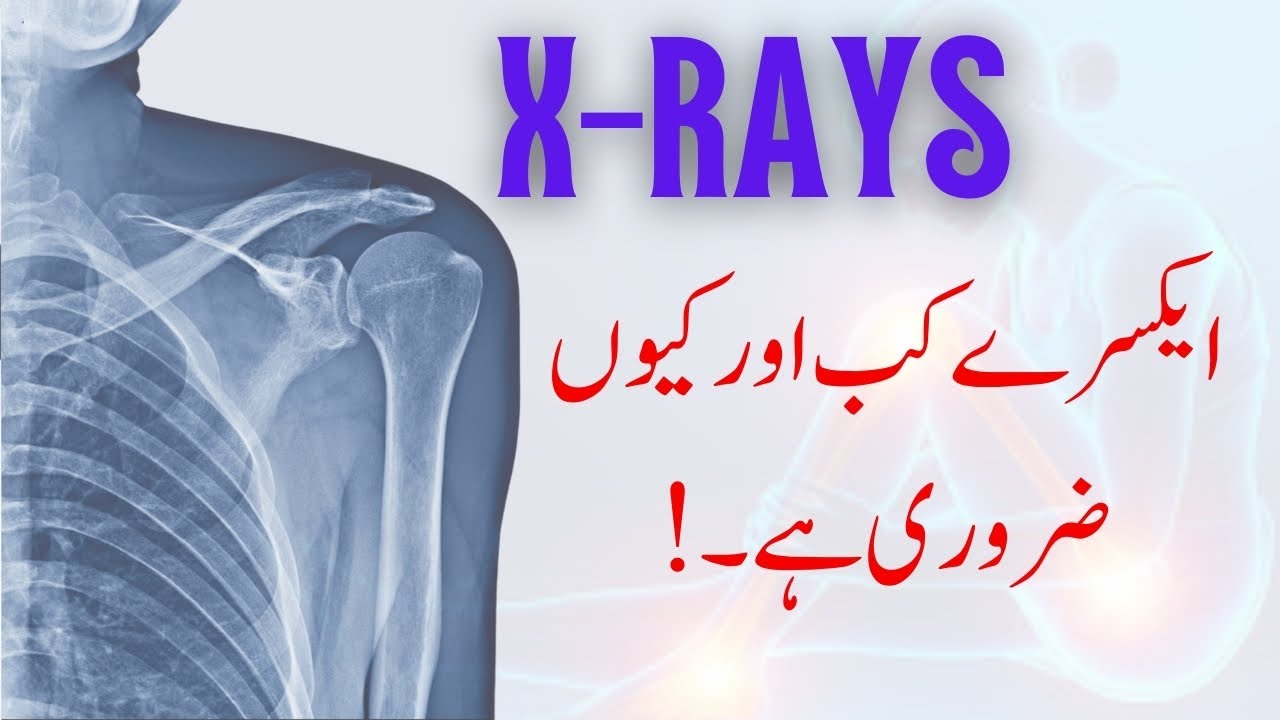 X-rays | Introduction of X-rays Production | How to Work X-rays | X ...