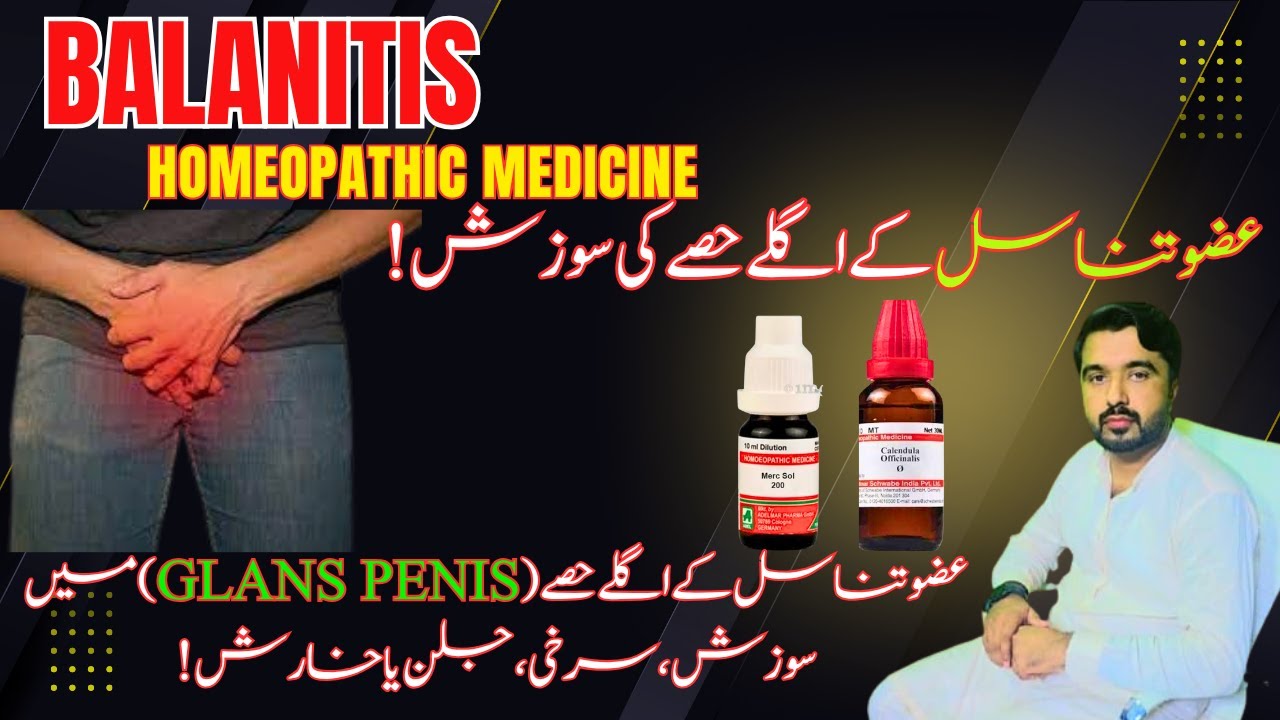 Balanitis? Causes, Symptoms & Treatment!Recurrent Balanitis!Balanitis ...