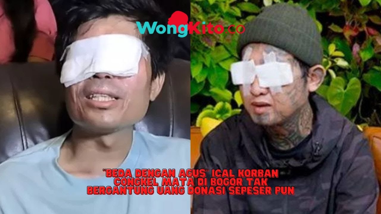"Beda dengan Agus" Ical Korban Congkel Mata di Bogor Tak Bergantung ...