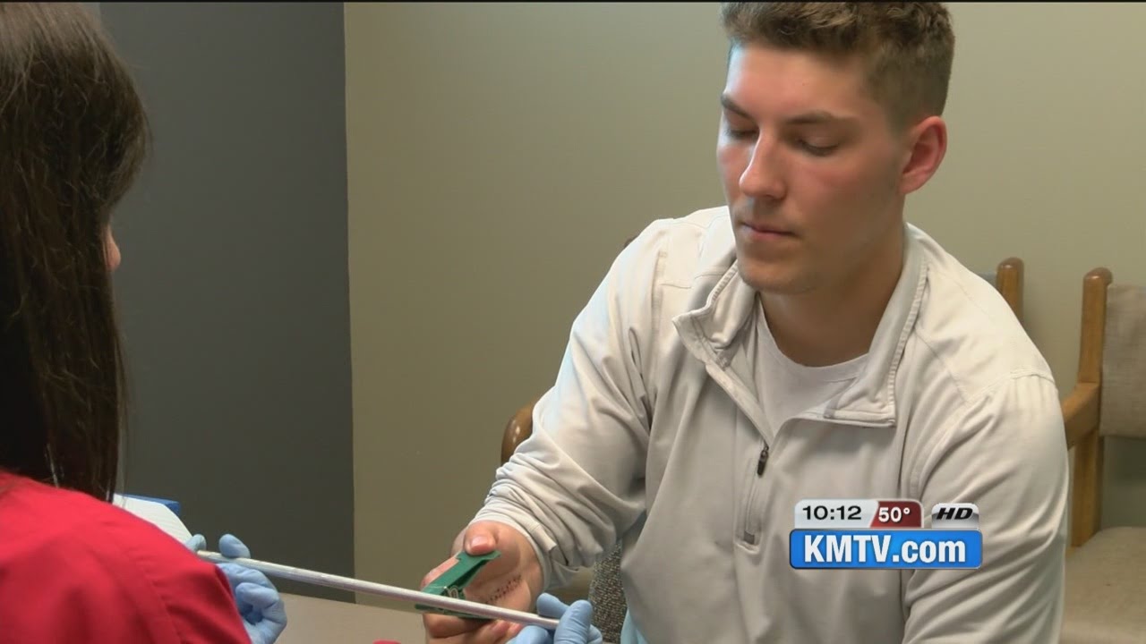 Hand reattachment surgery a success for young Nebraska man - YouTube