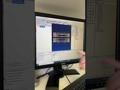How To Use Dentrix For Dental Hygienist