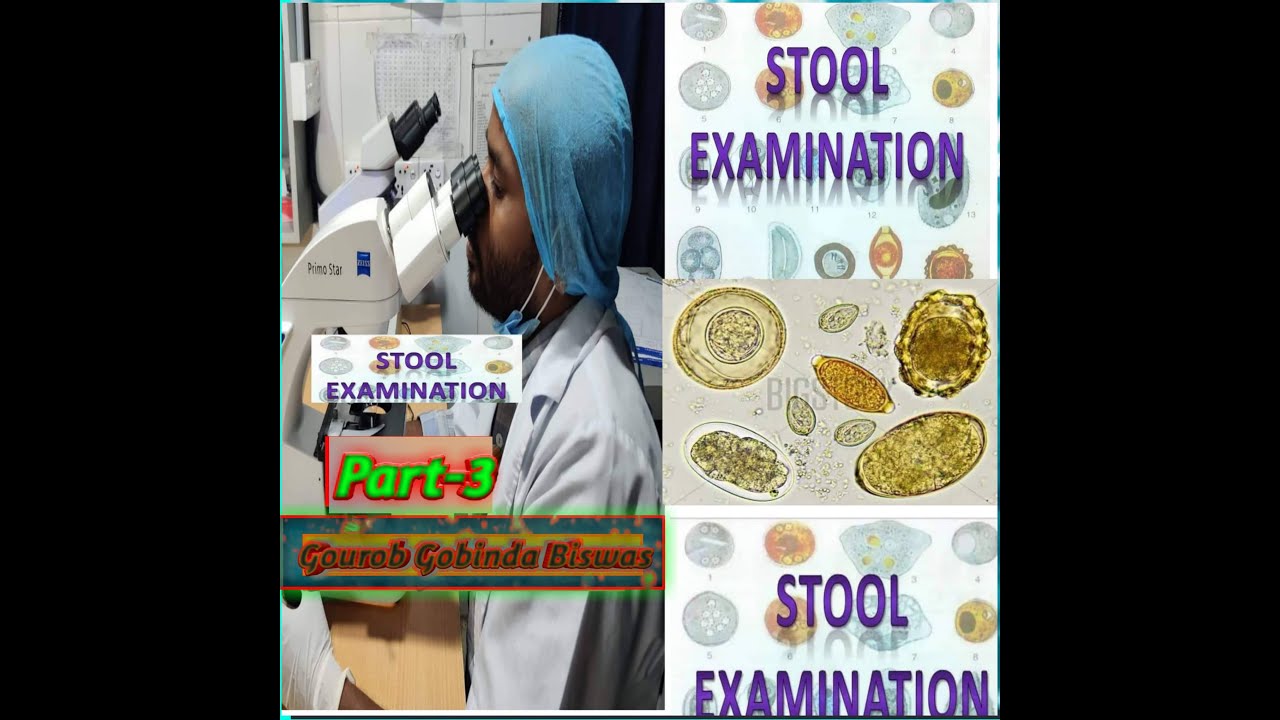 Stool examination under microscope. Test Procedure. Stool for ...