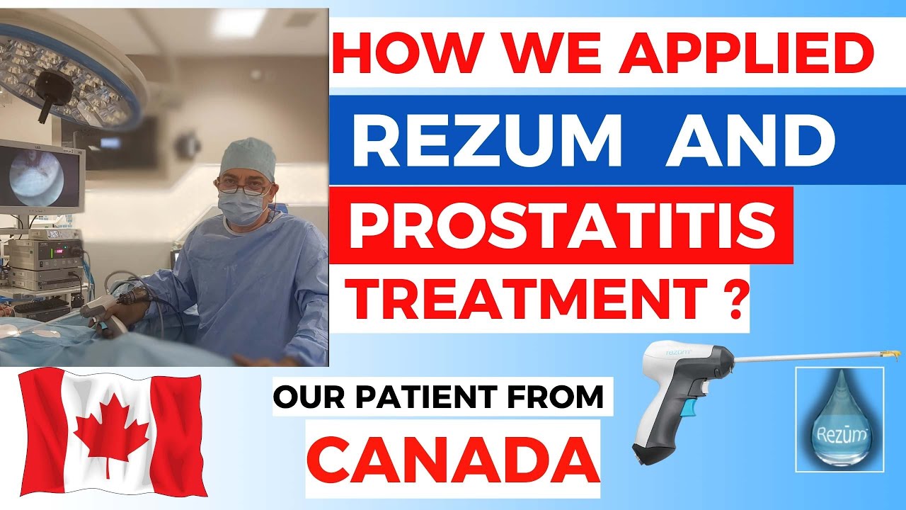 REZUM Procedure for BPH, Followed by Drainage of Prostatic Fluid - Our ...