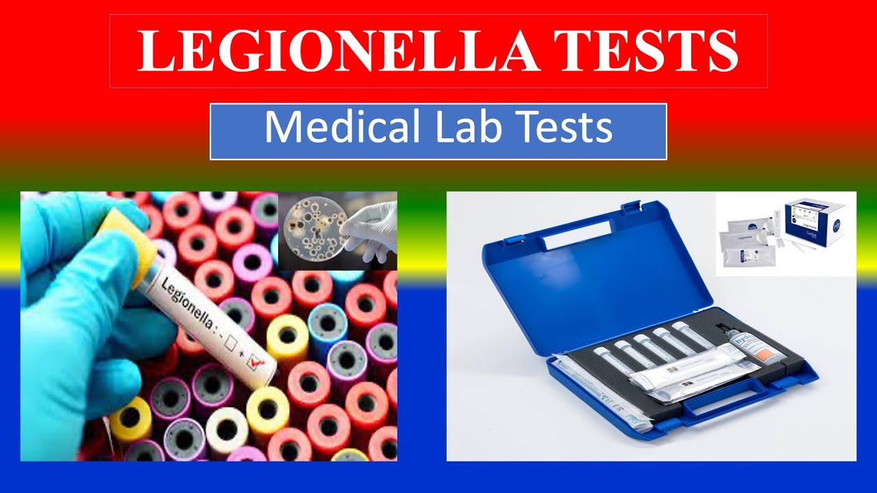 LEGIONELLA TESTS - Medical Lab Tests - What is ? , Uses , Need ...