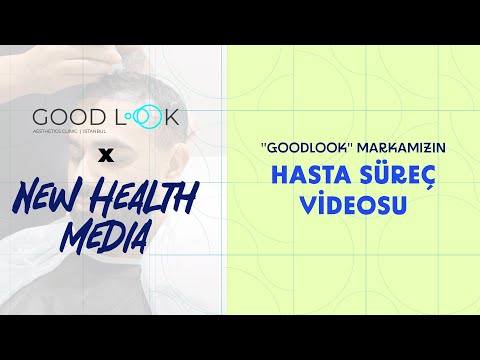 ''GoodLook'' markamızın hasta süreç videosu