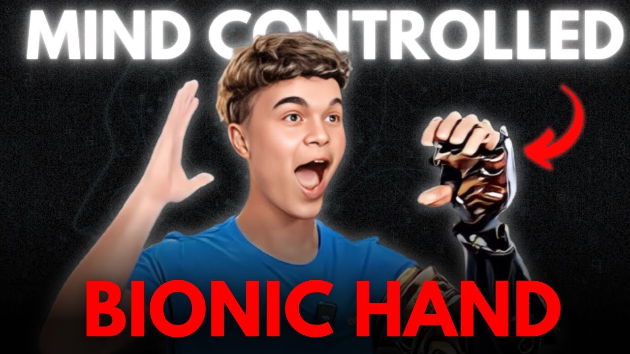 How Can You Control a Bionic Arm Without an Arm? (MIND BLOWN ...
