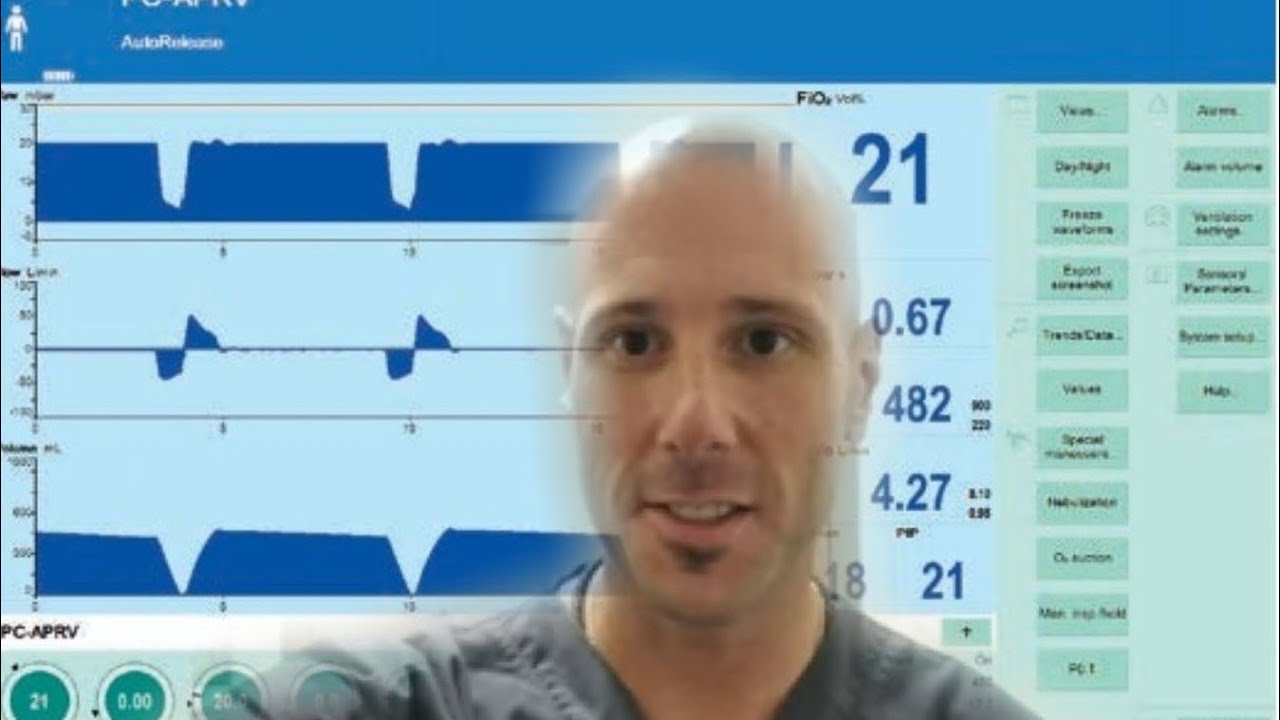 STEP BY STEP APRV VENTILATION EXPLAINED. - YouTube