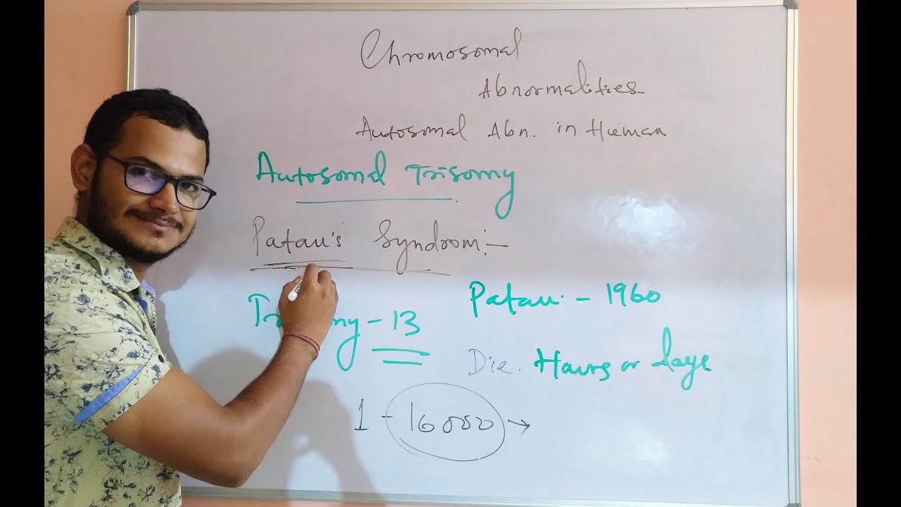 Autosomal Abnormalities in human - YouTube