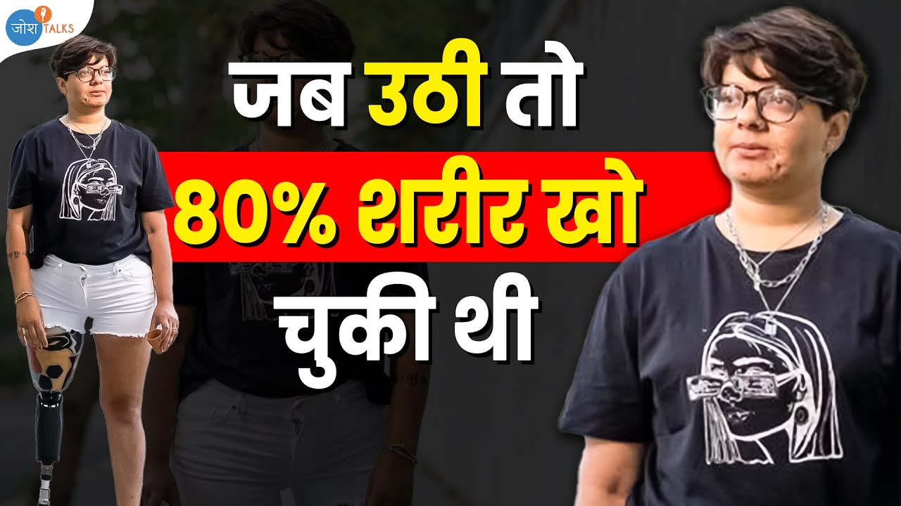 "मेरा चेहरा 2 हिस्सों में बट गया था" | Neha Bhatt | Josh Talks Hindi ...