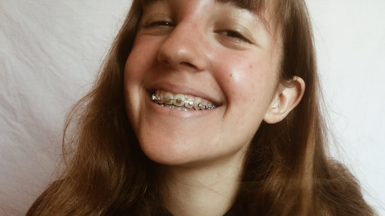 Respondiendo PREGUNTAS FRECUENTES sobre los BRACKETS 😁 - YouTube