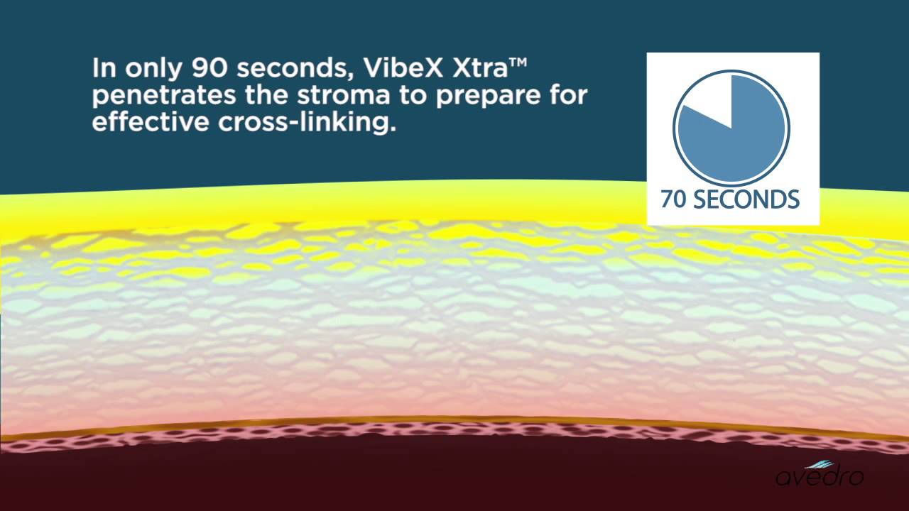 Lasik Xtra Animation - YouTube