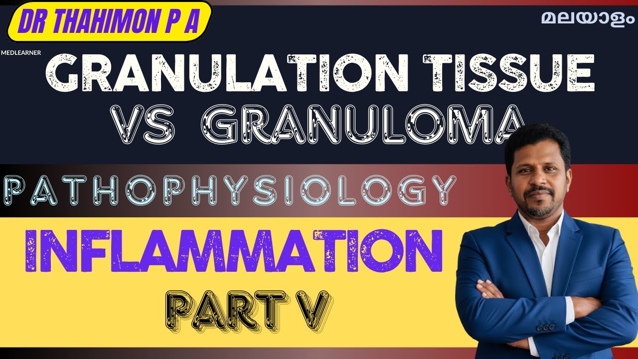 Granuloma vs Granulation Tissue Pathology Inflammation and Healing ...