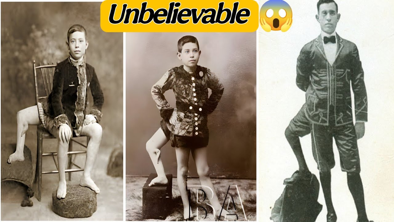 The impossible truth: A human has 3 legs. Find out the details in today ...