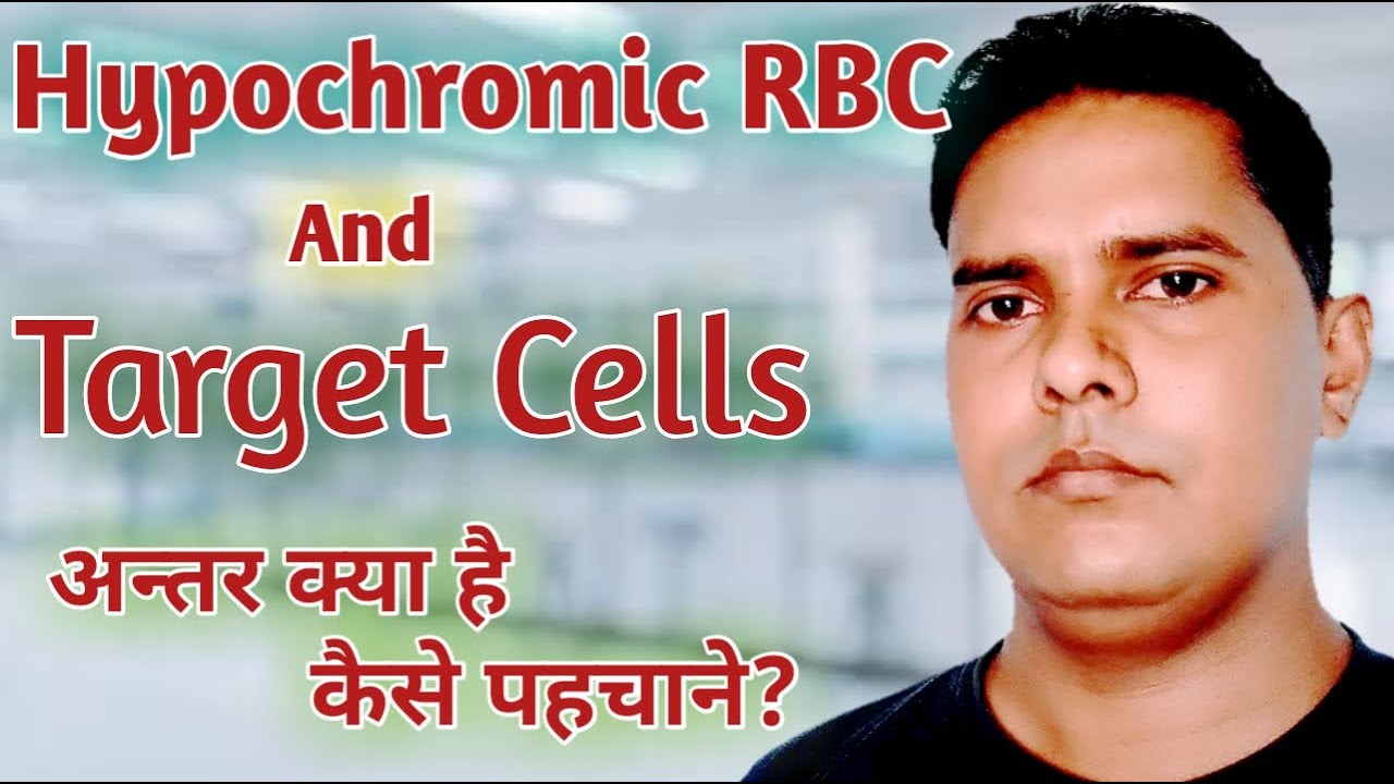 Difference between Hypochromic RBC and Target cells | Target cell under ...