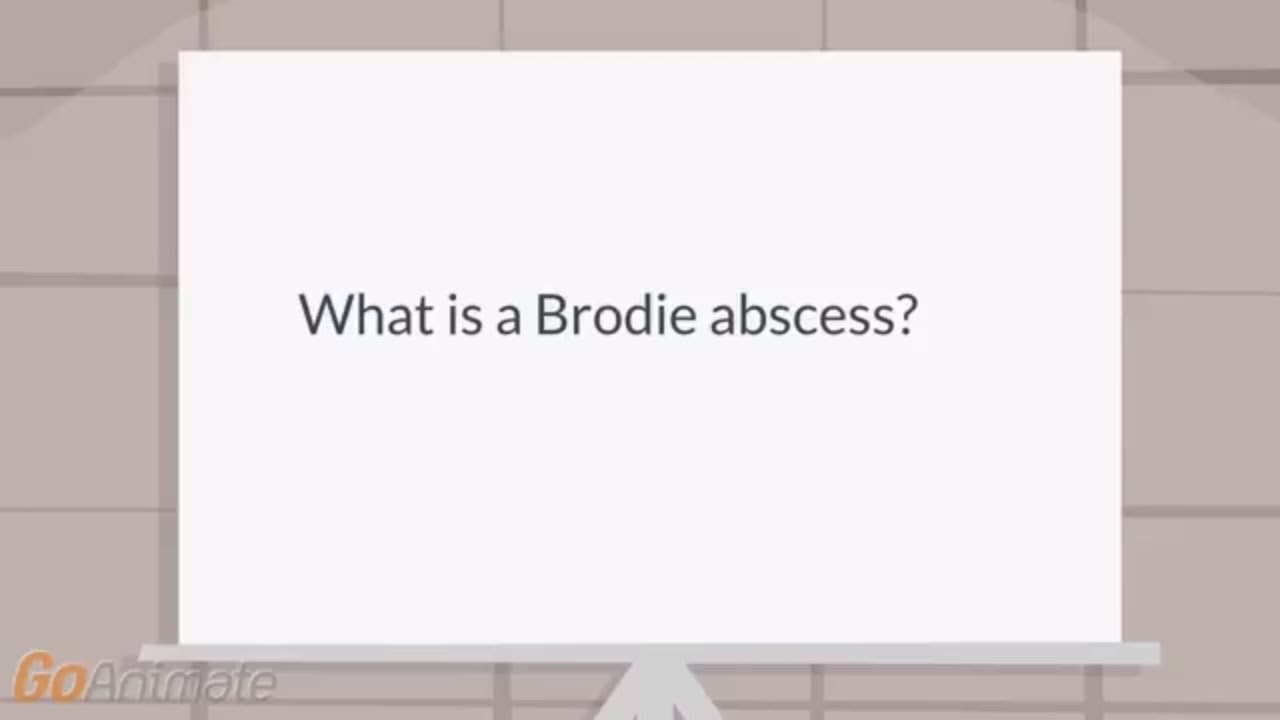 What is a Brodie abscess? - YouTube