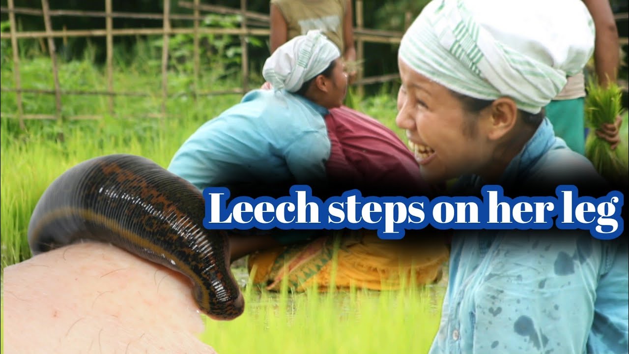 Jumping seeing the leech steps on her leg.. - YouTube