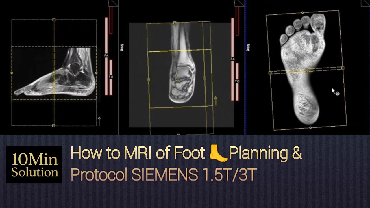 How to Plan an MRI of the Foot | Complete Guide - YouTube