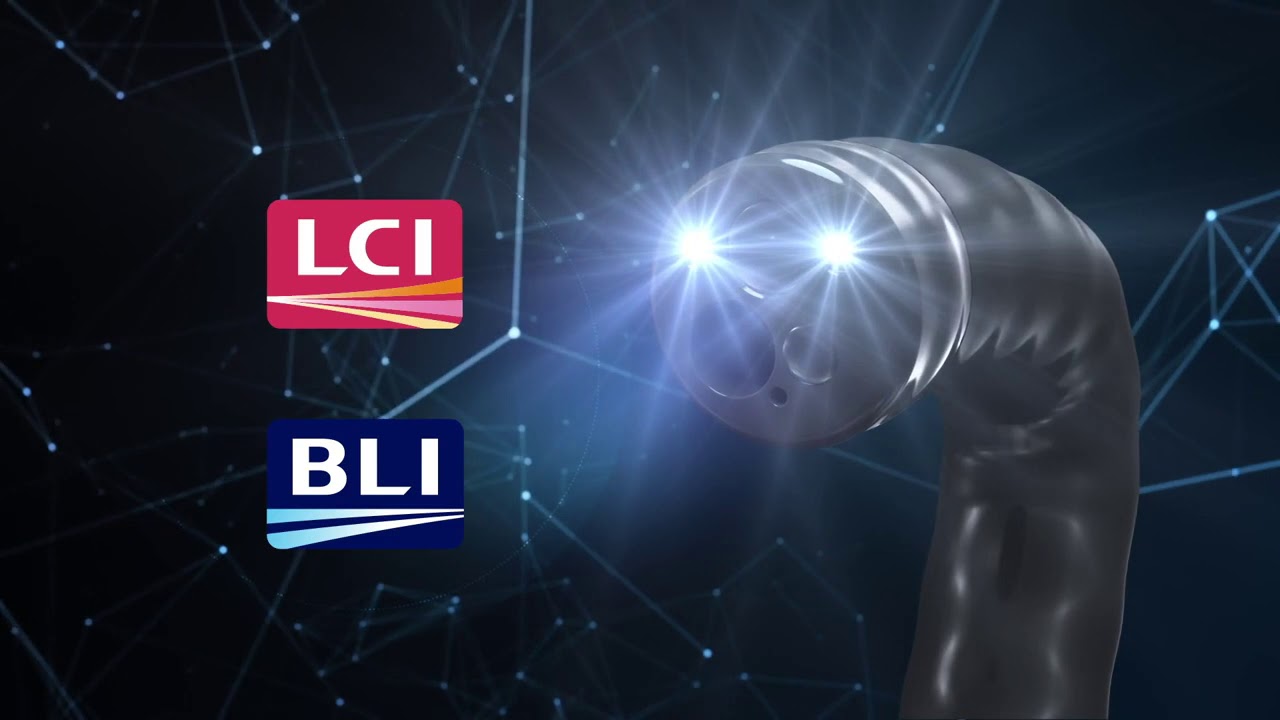 Introducing CAD EYE for colonic polyp detection and characterization ...