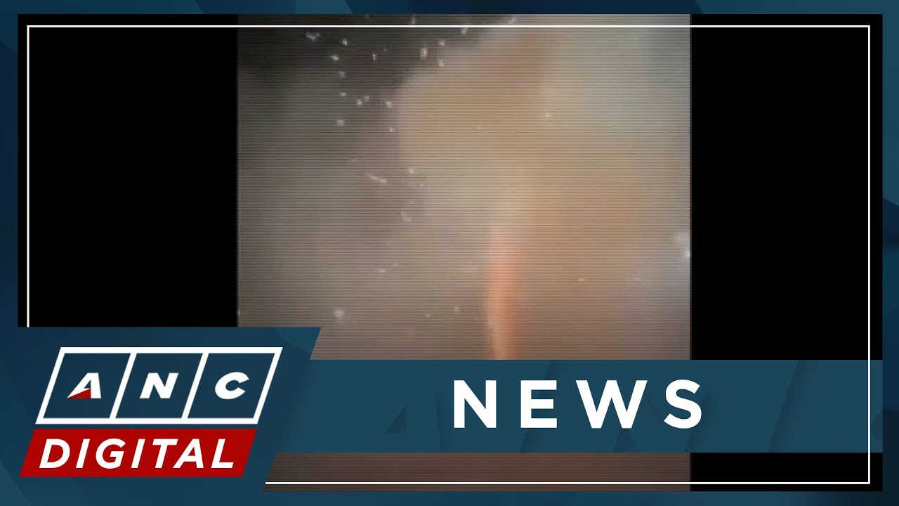 23-year-old in Cebu dies in firecracker incident | ANC - YouTube