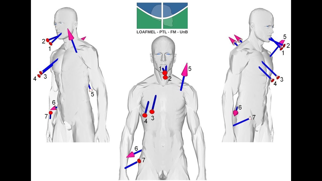 Representação Tridimensional de Trajeto de Projetil de Arma de Fogo ...