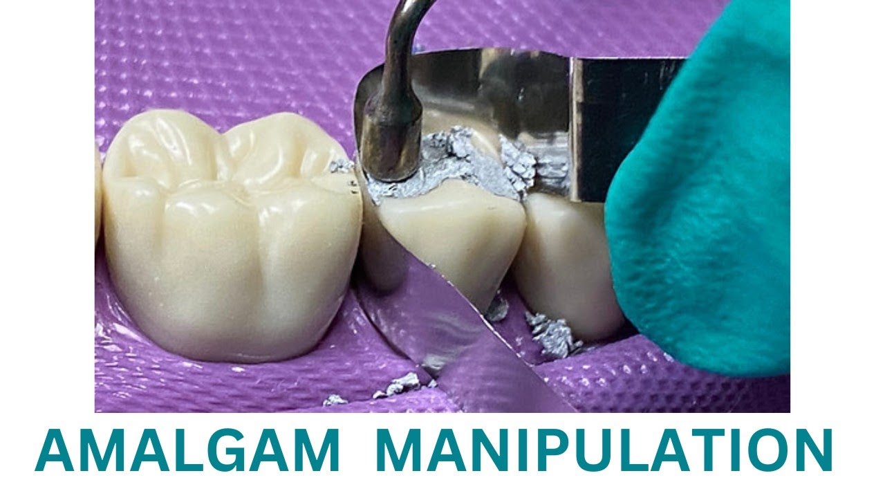 Dental Amalgam Manipulation | Trituration | Condensation | Polishing ...