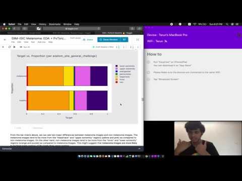 [PART 2] Skin Cancer Detection with PyTorch - YouTube