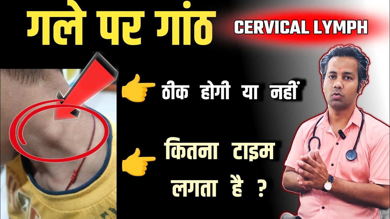 😲 CYST ? छोटे बच्चो की गले की गांठ | Neck cyst | neck lump ? Dr tarun ...