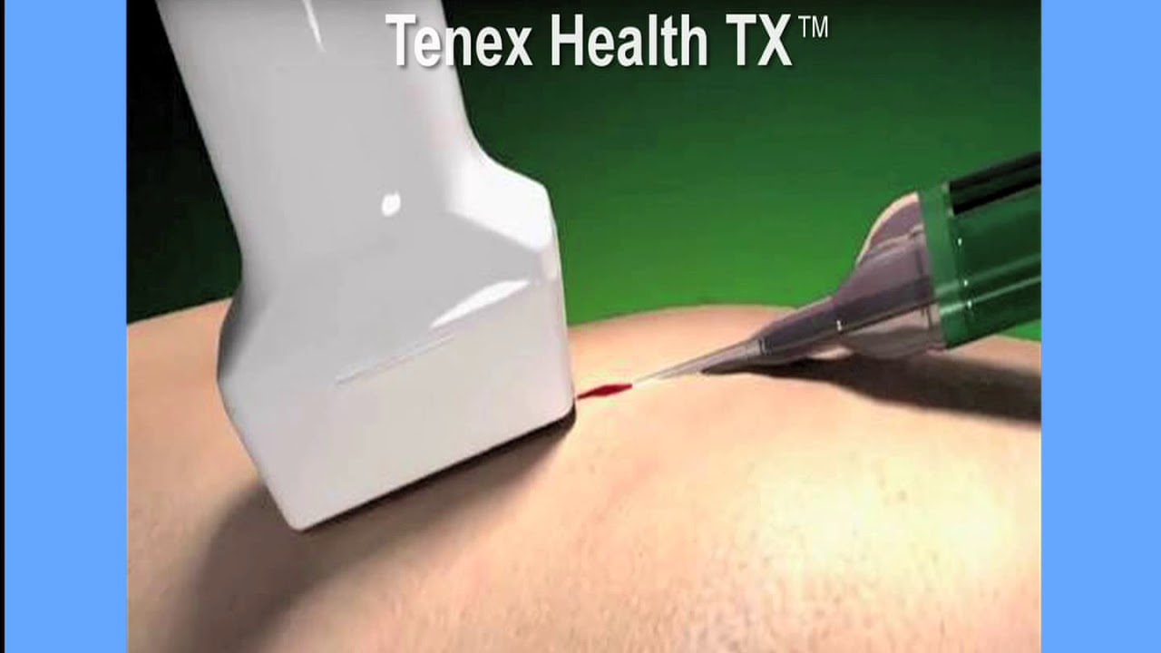 How It Works - Tenex Health TX - YouTube
