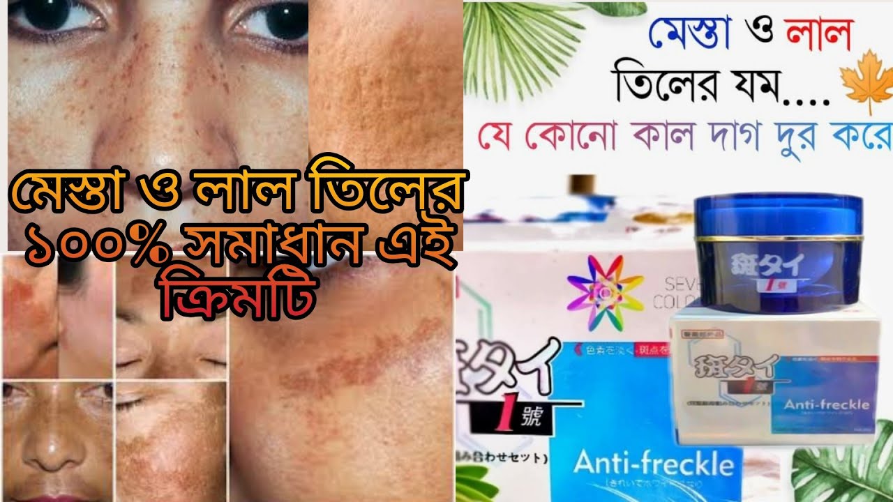Anti Freckle Cream নাকি পুরোনো মেস্তা ও লাল তিলের যম👹? সত্যিই কি🤔 ...