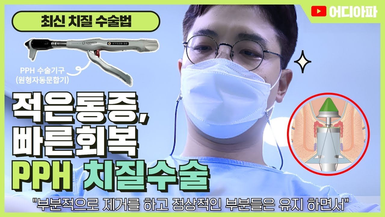 [치질치료] 통증적고, 회복빠른 최신 수술법이 있다?(Feat. PPH수술) - YouTube