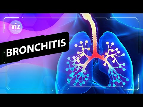 Bronchitis Explained
