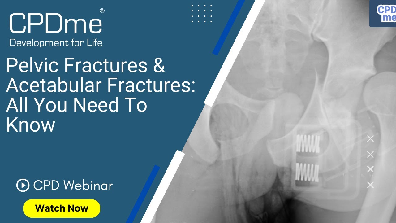 Pelvic fractures & acetabular fractures: all you need to know by John ...