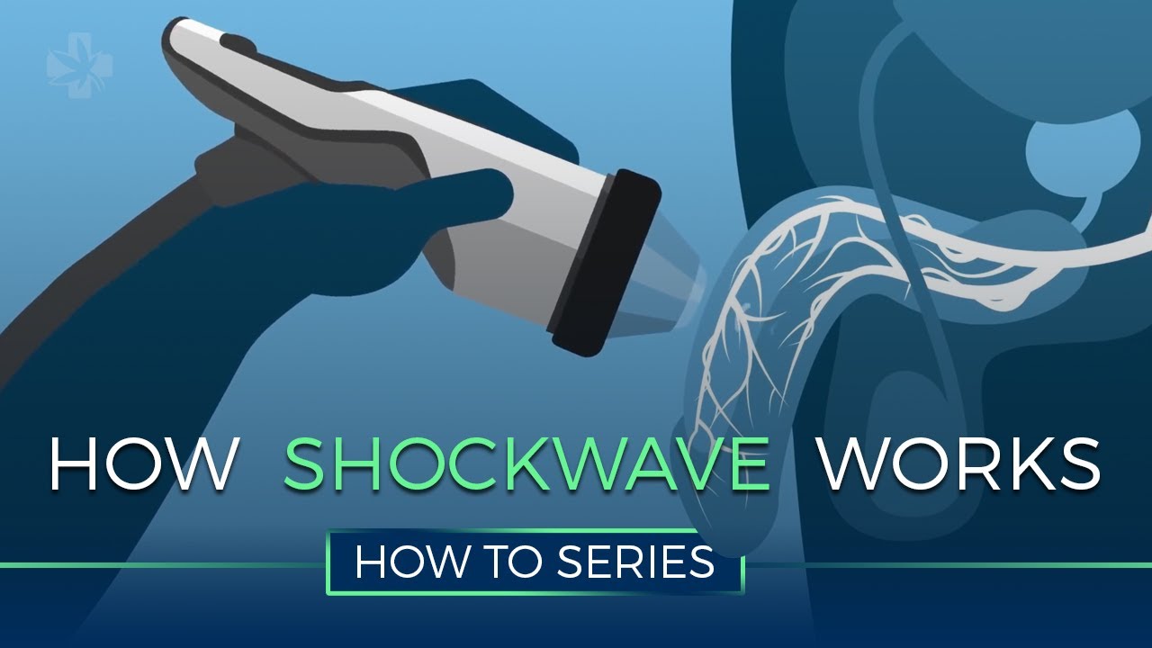How Shockwave Therapy Works - HOW TO SERIES - YouTube