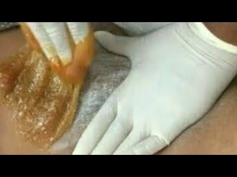 Brazilian hairy legs hard wax for beginners(12)#viral#brazilian#waxing#hardwax#wax#brazillianwax