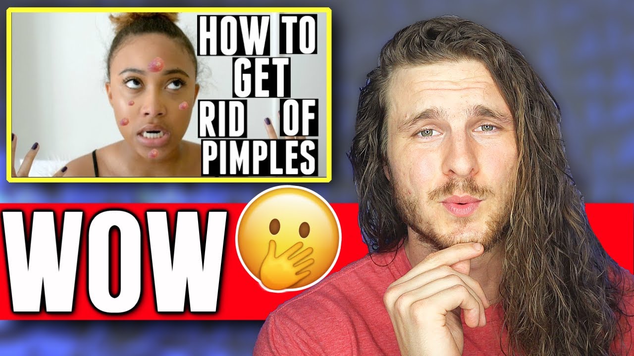 How To Get Rid of Pimples OVERNIGHT | REACTION - YouTube