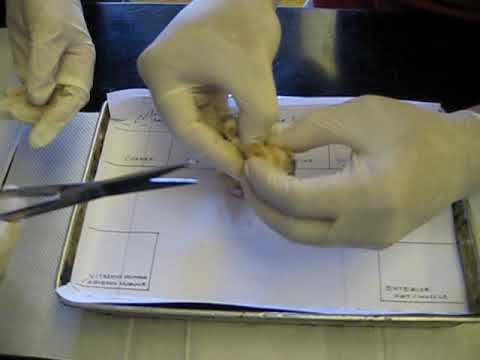 2009 Eyeball Dissection Demo Abello Best Hinds - YouTube