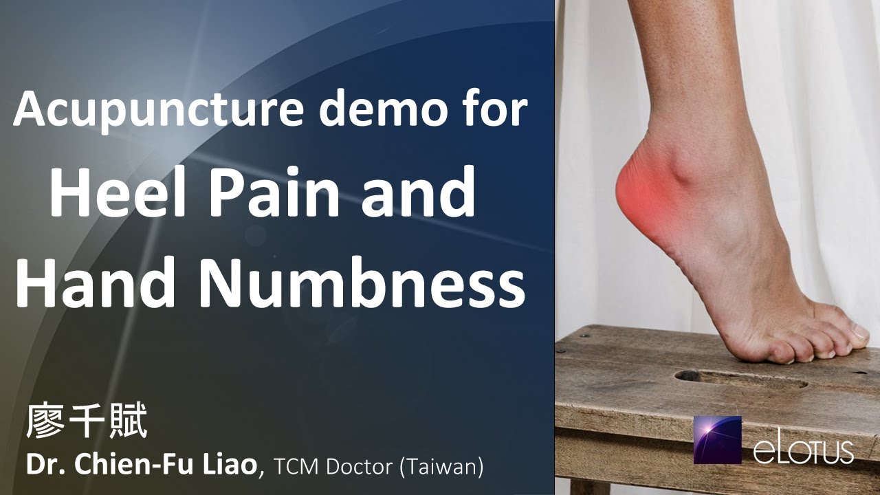 Heel Pain And Hand Numbness by Chien Fu Liao - YouTube