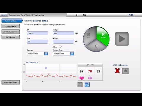 How to setup minimally invasive hemodynamic monitoring using LiDCO ...