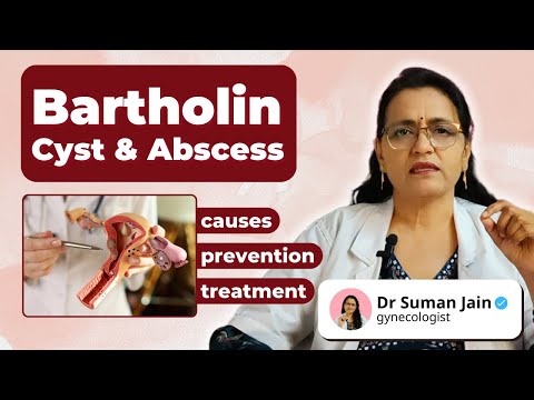 Bartholin Cyst kya hota hai? | Symptoms, Causes & Treatment | Dr. Suman Jain