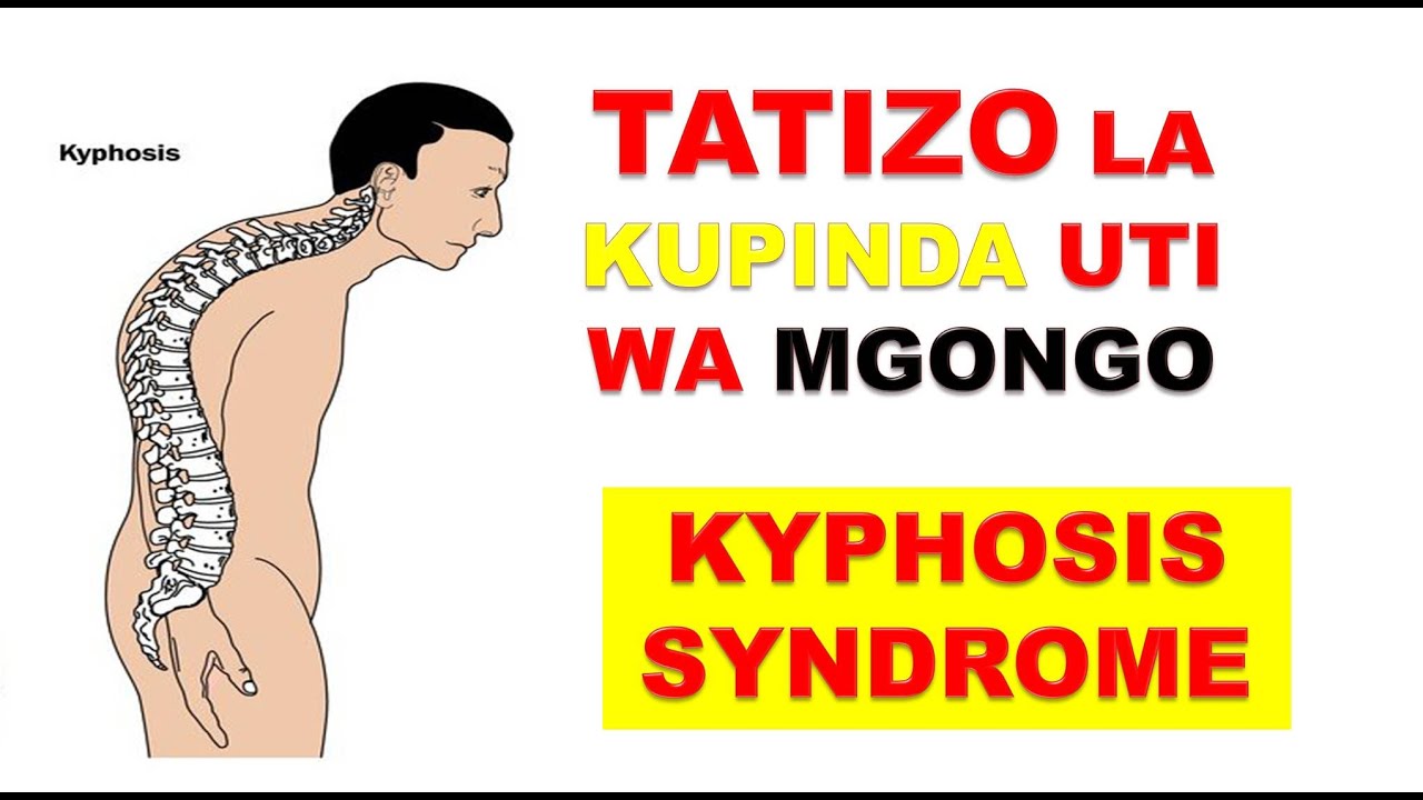 TATIZO LA KUPINDA UTI WA MGONGO | KYPHOSIS SYNDROME - YouTube