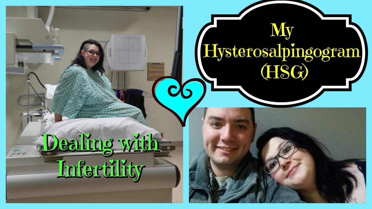 Details Of My Hysterosalpingogram HSG Test For Infertility! - YouTube