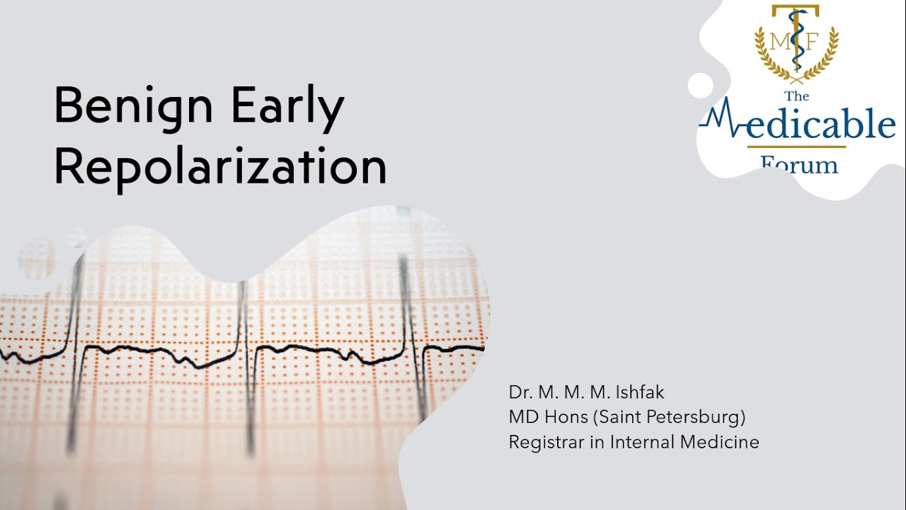 Benign Early Repolarization - ECG - YouTube